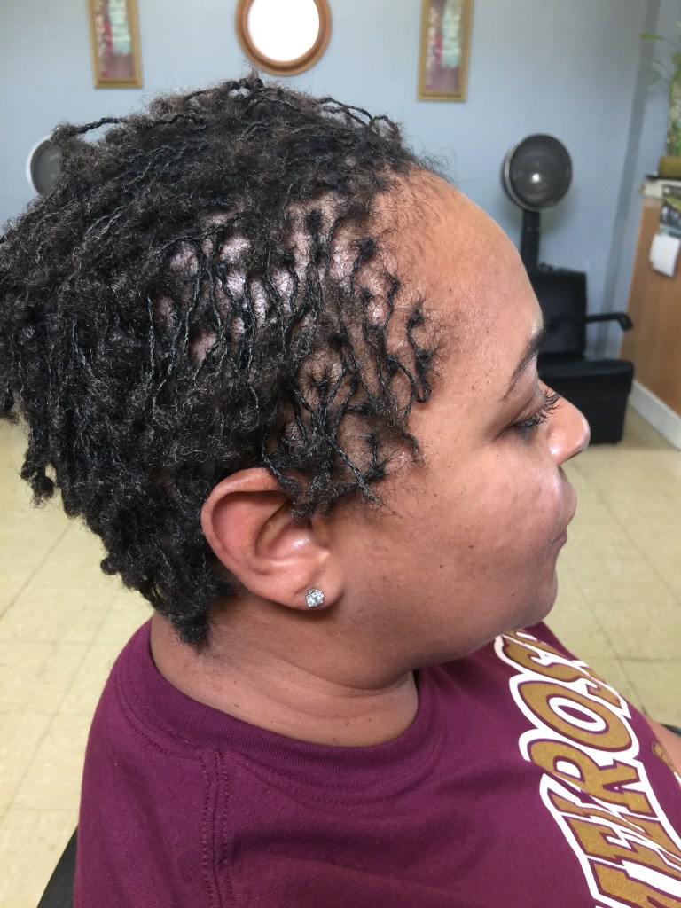 My Sisterlocks Birthday: Install Complete!!! – AndisLocks